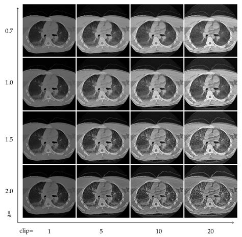 Algorithms Free Full Text A Weighted Histogram Based Tone Mapping