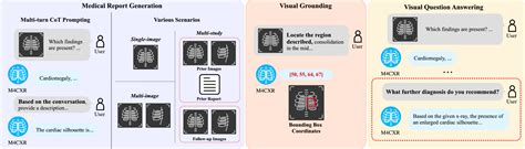 Enhancing Chest X Ray Datasets With Privacy Preserving Large Language Models And Multi Type
