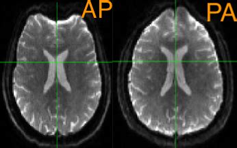 MRtrix Tutorial 4 Preprocessing Andy S Brain Book 1 0 Documentation