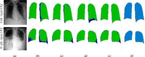 Figure 3 From Sample Efficient Lung Segmentation Using Group Structured