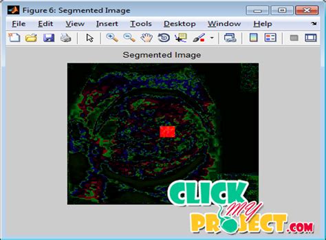 Automatic Detection And Measurement Of Structuresin Fetal Head Ultrasound Volumes Using