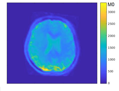 An Example Proton Density Map Calculated For Subject 1 Download Scientific Diagram