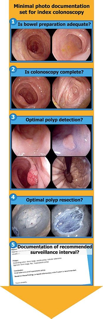 Poor Colonoscopy Prep