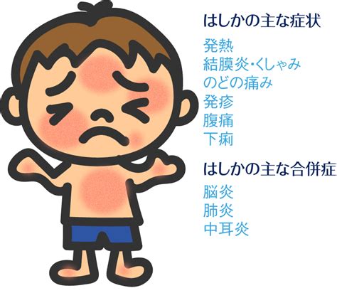 【感染拡大中】各地で感染確認！日本国内で3年ぶりに蔓延するはしかの危険性 話題のニュー速まとめちゃんねる