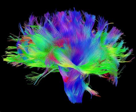 The Art Of Mapping Neural Connections By Sabrina Singh Medium