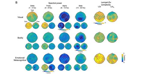 Neural Correlates Of The Dmt Experience Assessed With Multivariate Eeg