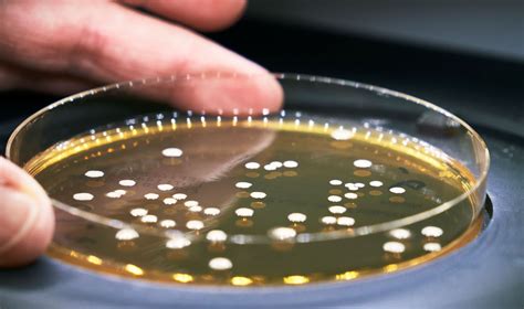 Probi® What Are Probiotics