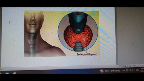 Speed Revision Biology උසස්පෙළ 5 2 අන්තරාසර්ග ආබාධ 344 Episode ♥