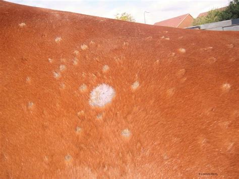 Ringworm Treatment For Humans This Is The Simplest Way 3 Ways To