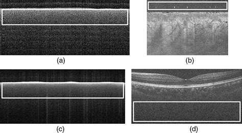 Adaptive Compounding Speckle Noise Reduction Filter For Optical