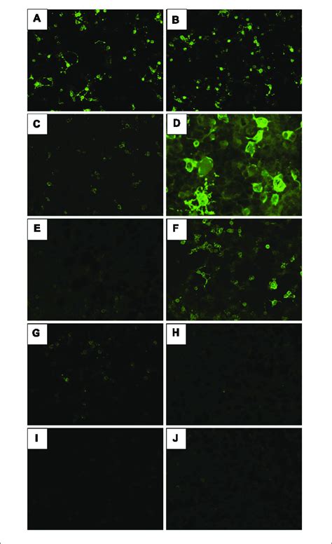 The Anti Nmda Receptor Anti Nmdar Antibodies In Csf Acegi And