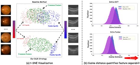 논문 리뷰 Robust Multimodal Learning for Ophthalmic Disease Grading via Disentangled Representation