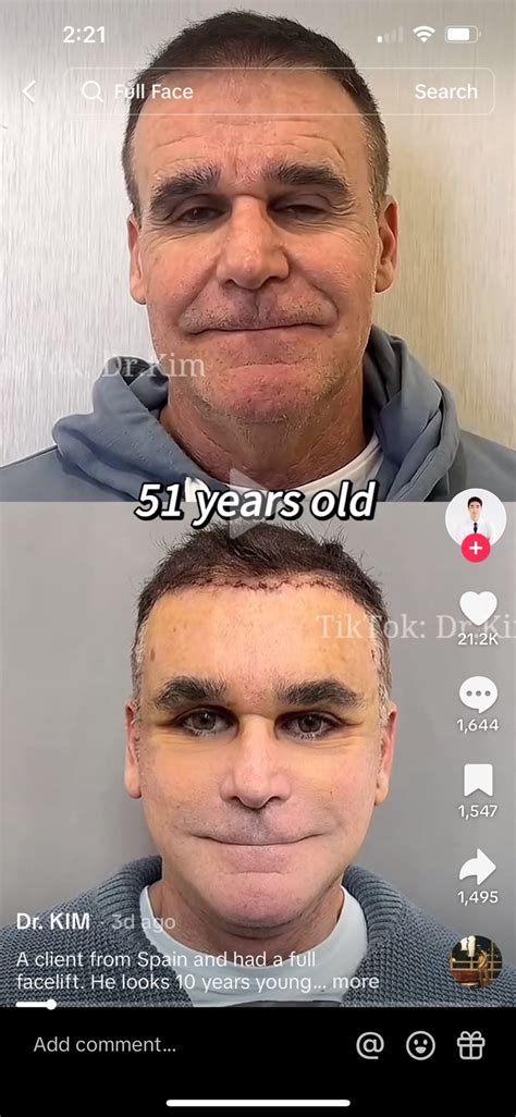This Plastic Surgeon I Found On Tiktok Runcannyvalley