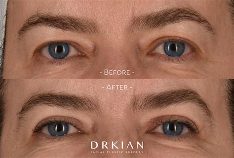 Infusion Therapy Bbs Clinic