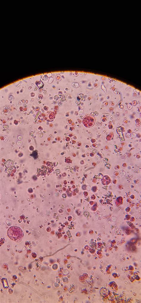 Sedimento Urinario Activo teñido Grupo Zoovet