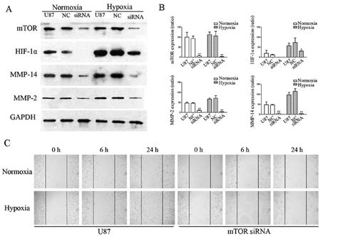 Effect Of Sirna On Expression Of Mtor And Downstream Molecules As Well Download Scientific