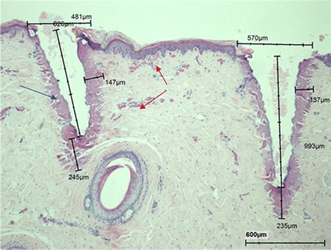 Histology Of Acute Effect Following Sequential Radiation Of 240 Mj