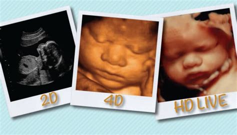 Why Non Medical 3d 4d Ultrasound Training Is Gaining Popularity 3d 4d Hd Ultrasound Training