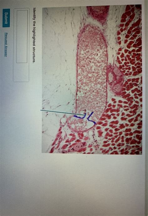 Solved Identify The Highlighted Structure Submit Request