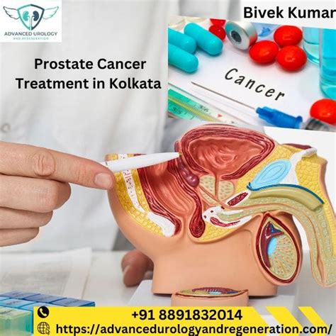 Prostate Cancer Treatment In Kolkata Bivek Kumar Bivek Kumar Medium