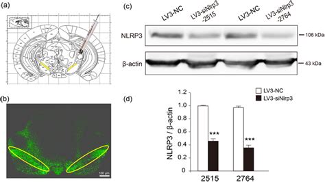 Intracerebral Stereotactic Injection With Lv3‐sinlrp3 Inhibited Nlrp3 Download Scientific