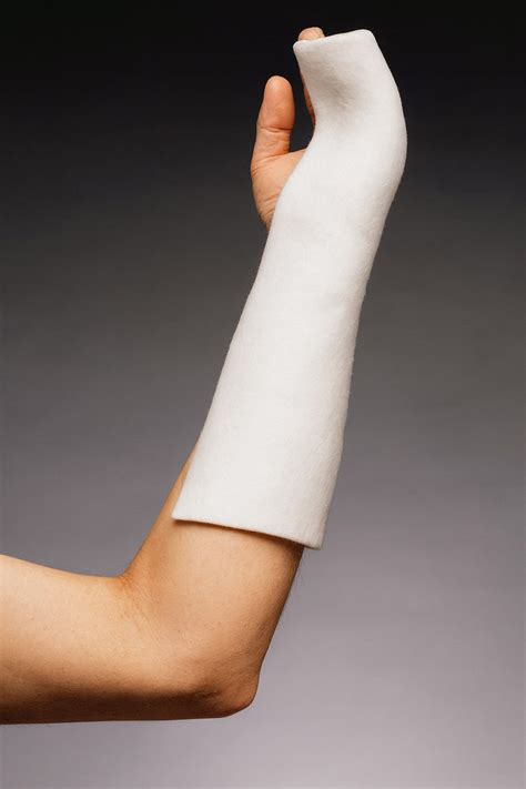 Ulnar Gutter Splint Kit — Boxer Fracture And 4th 5th Metacarpal Treatment