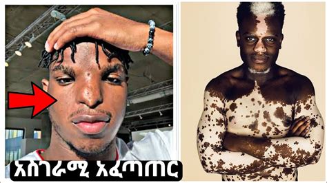 10 አስገራሚ አፈጣጠር ያላቸው እና የተገፉ ሰዎች Youtube