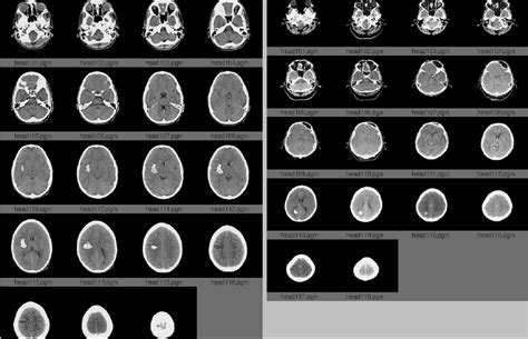 left same query as in the previous figure right second highest