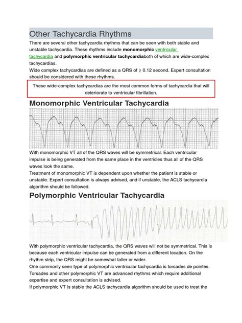 Polymorphic Ventricular Tachycardia Vs Ventricular Fibrillation Polymorphic Ventricular Tachycardia Vs Ventricular Fibrillation