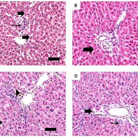 Figure1 Photomicrographs Showing Hematoxylin And Eosin Stained Liver Download Scientific