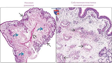 Гистология нос