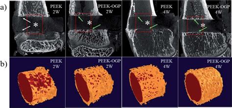 A Characterization Of Local Tibial Metaphysis Surrounding Different Download Scientific
