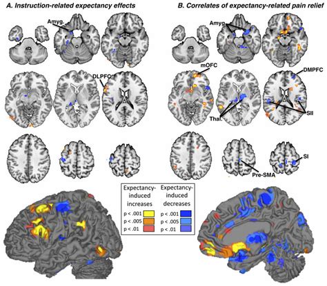 Expectancy Effects During Drug Treatment Download Scientific Diagram
