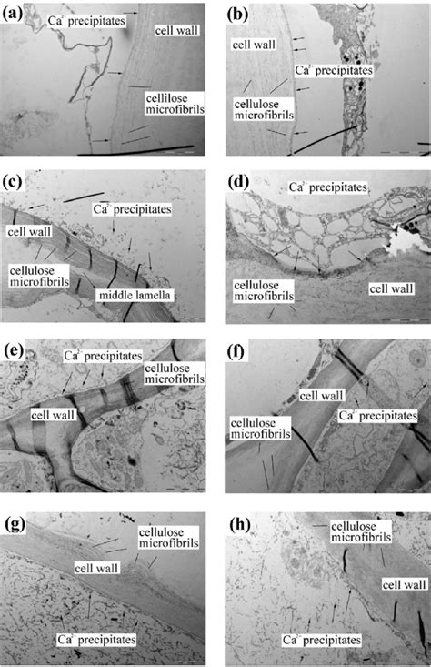 Effects Of Ultrasound And Calcium Lactate On The Calcium Distribution