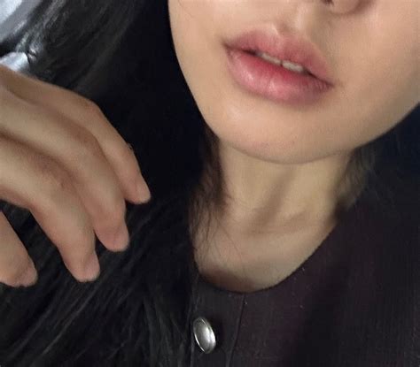 신사역피부과 입술필러후기 당일 일주일 멍 아픔 주의사항 네이버 블로그