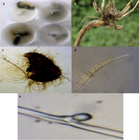 Figure 1 From Genetic Diversity Analysis Of Gaeumannomyces Graminis Var