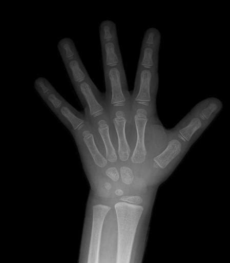 X Ray Id Zfisb Fsod Dyjv Object Detection Dataset By Roboflow100vl Fsod