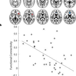 Functional Connectivity Between The Anterior Cingulate Cortex Download Scientific Diagram