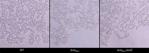 Edges Of Monolayers Formed By Sliding M Smegmatis Cells Of Wt And Download Scientific Diagram