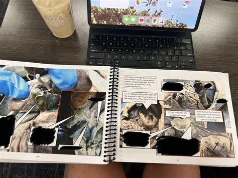 Prelab 10 Abdominal Cavity Pt 2 Diagram Quizlet