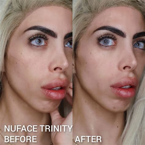 Foreo Bear Vs Nuface Trinity But Who Delivered The Best Results