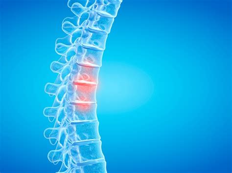 척추측만증 연세위너스재활의학과