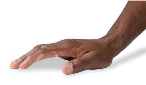 Static Splints Products Performance Health