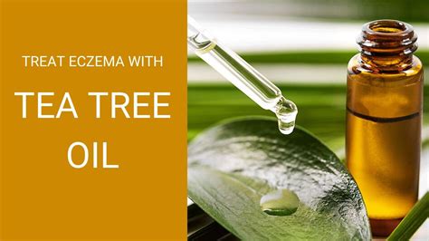 Which Green Tea Is Best For Eczema At Max Bosch Blog