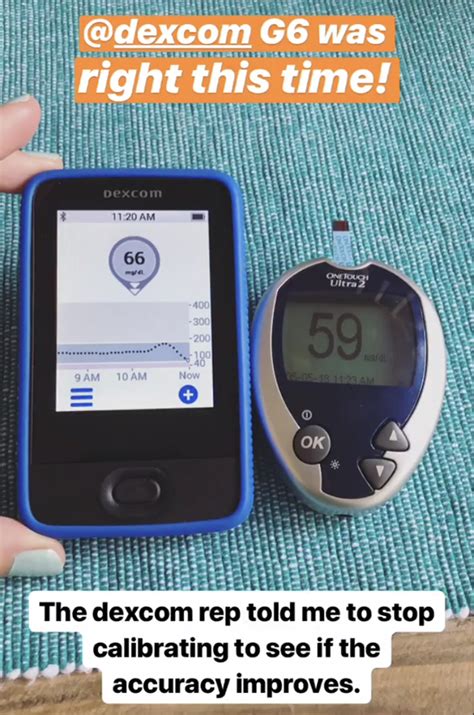 Dexcom G Review Artofit