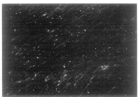 Scanning Electron Micrograph Showing Enamel Finish Of Chemically Cured Download Scientific