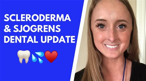 Scleroderma And Sjogrens Amazing Dental Update Youtube