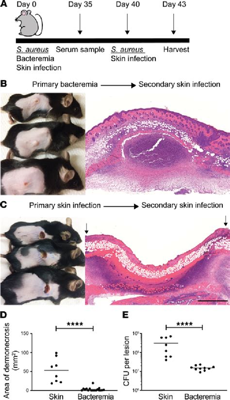 Figure 1 From Staphylococcus Aureus α Toxin Suppresses Antigen Specific T Cell Responses