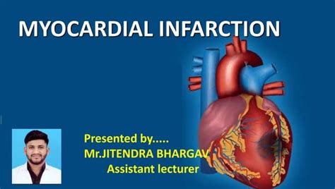Myocardial Infarction Slideshare Pptx Myocardial Infarction Slideshare Pptx