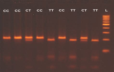 Molecular Genetic Analysis Of The Pcr Rflp For The Detection Of Single Download Scientific
